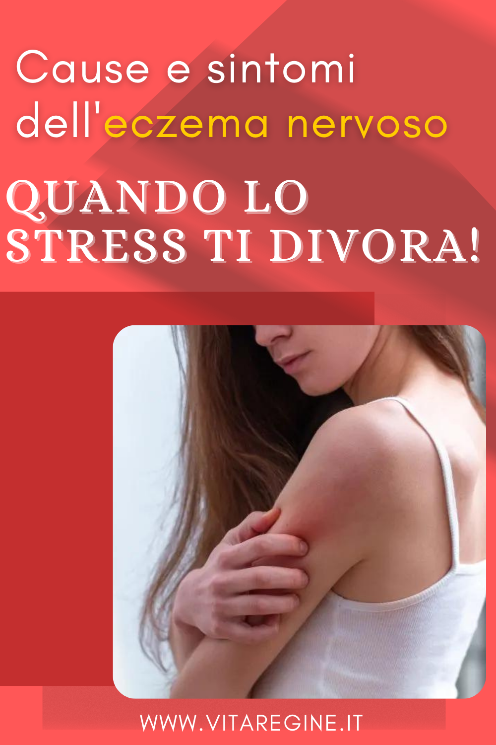 Cause e sintomi dell'eczema nervoso: quando lo stress ti divora! - La ...